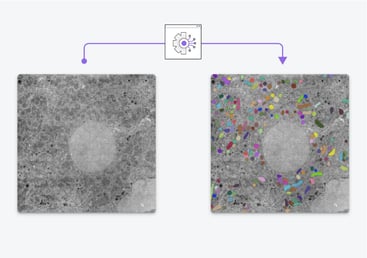 FAST-EM | Ultra-fast automated multibeam electron microscope